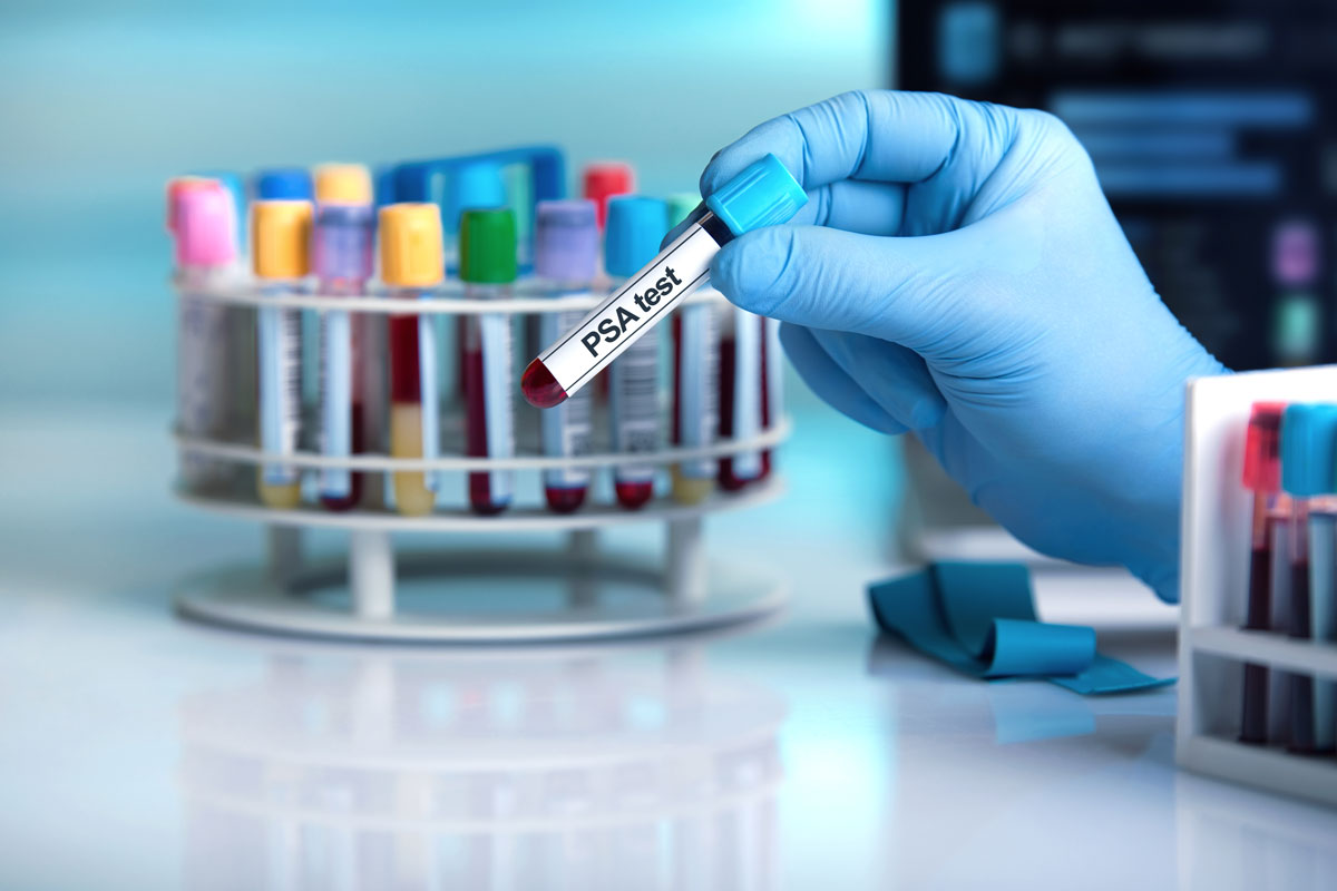 PSA Testi nedir? Neden Yapılır? - Prof. Dr. Özgür Uğurlu PSA Testi nedir? Neden Yapılır? - Prof. Dr. Özgür Uğurlu